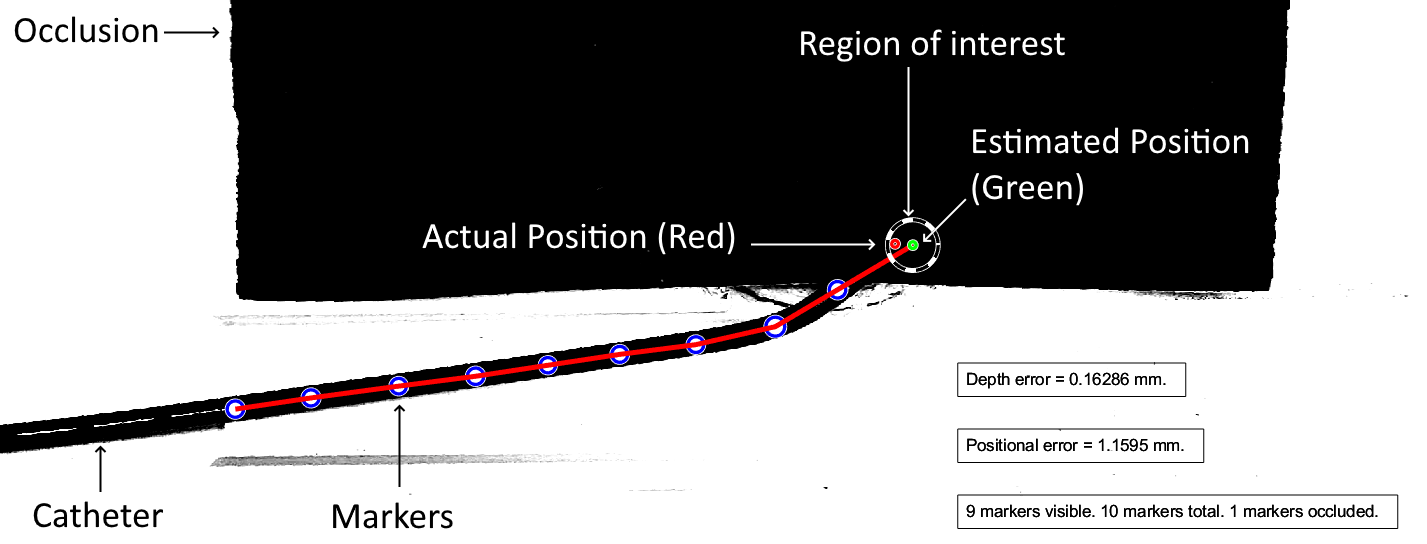 Catheter Detection Tracking And Virtual Image Reconstruction Senior