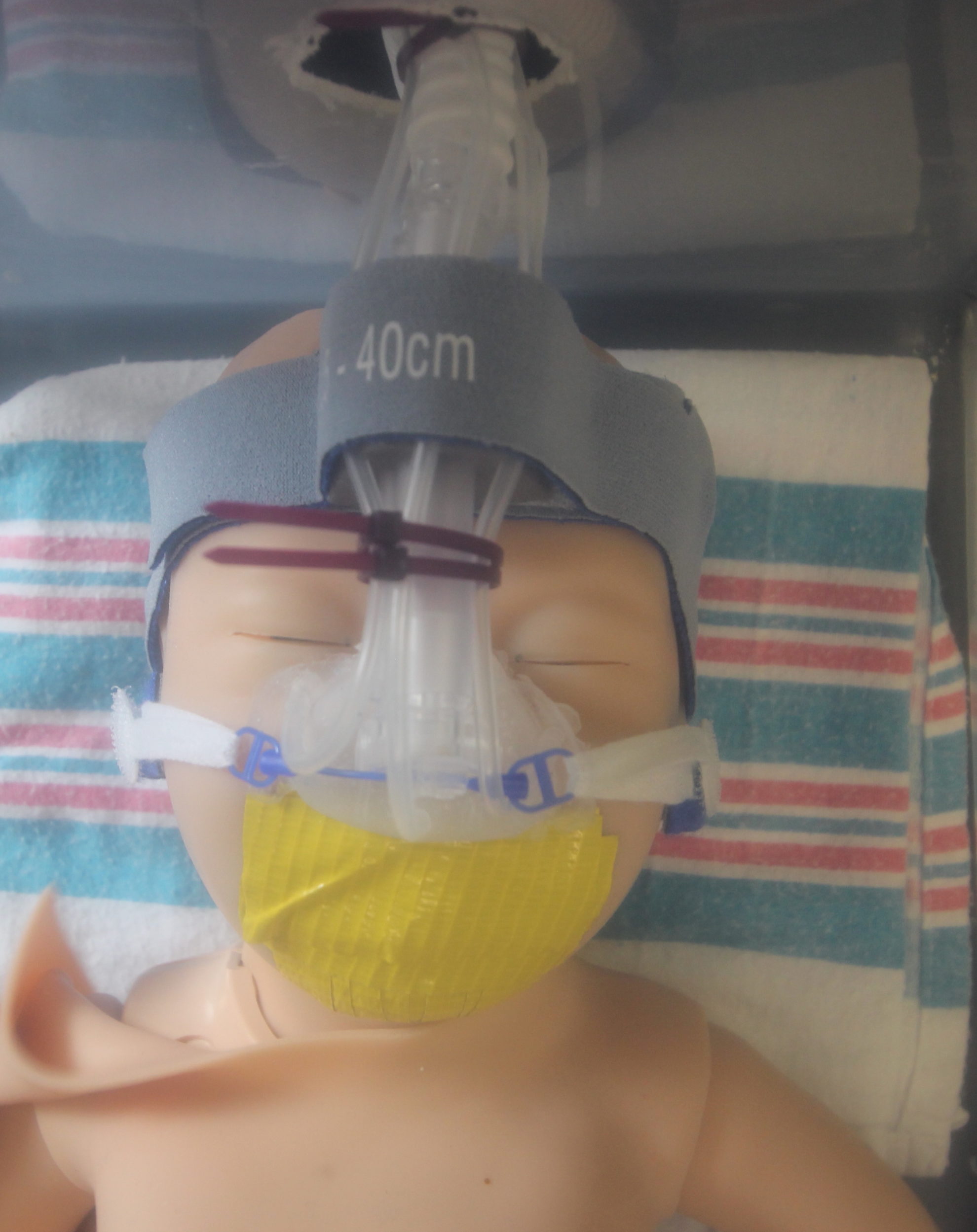 Neonatal CPAP Mask - Senior Design Day