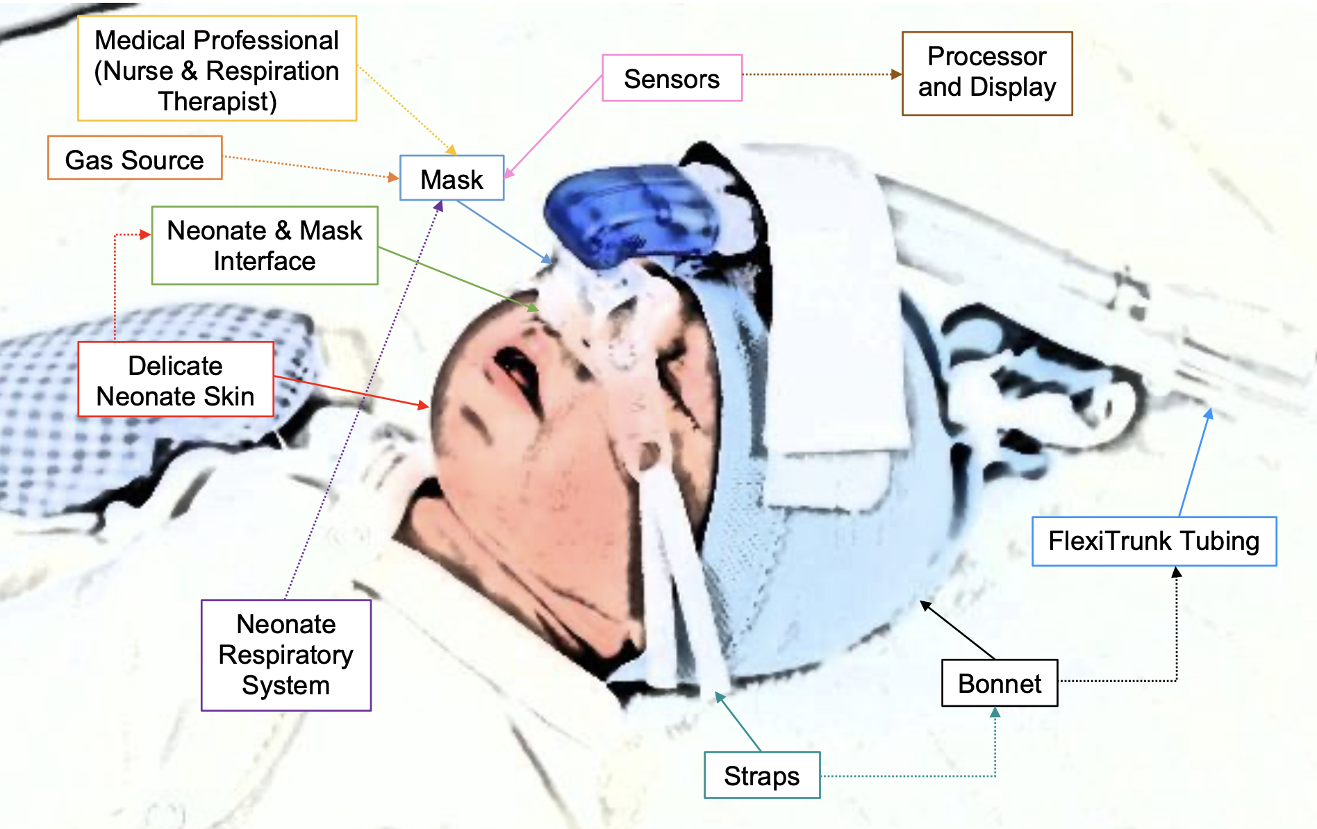 Neonatal CPAP Mask - Senior Design Day