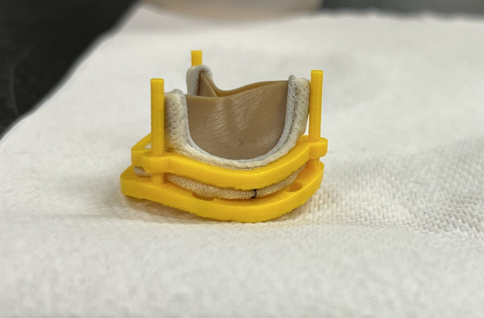 AortiSeal Ring Securement System - Senior Design Day