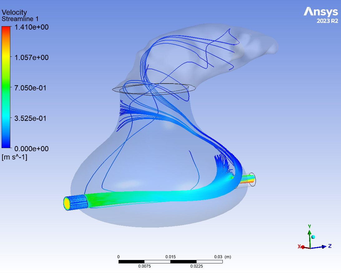 Cardiac Phantom Model for Left Atrial Appendage Occlusion Procedures ...