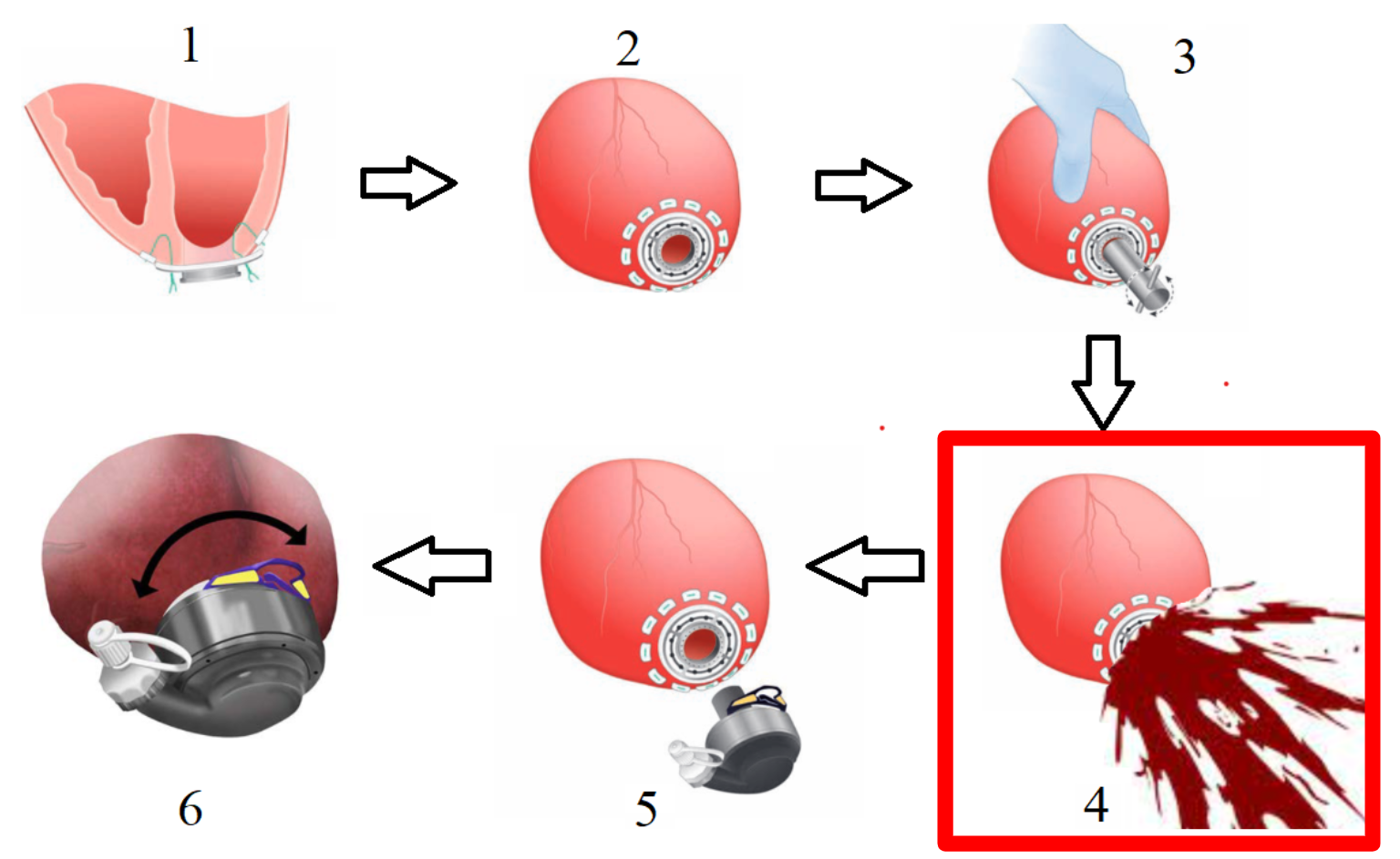SplashGuard - Senior Design Day